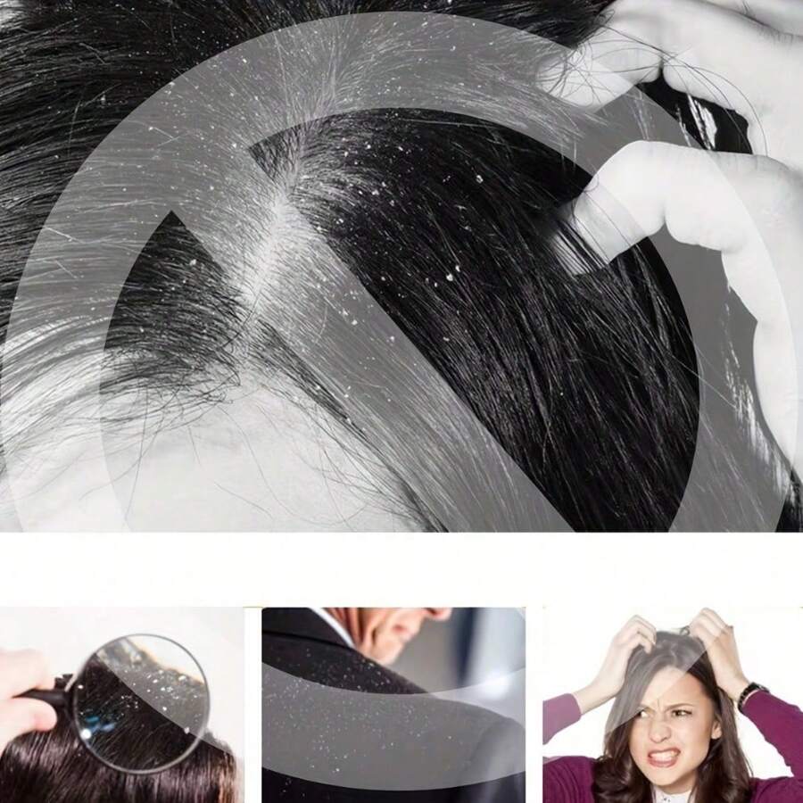 Premium Stainless Steel Comb - Effective Dandruff Remover, Lice Comb ...