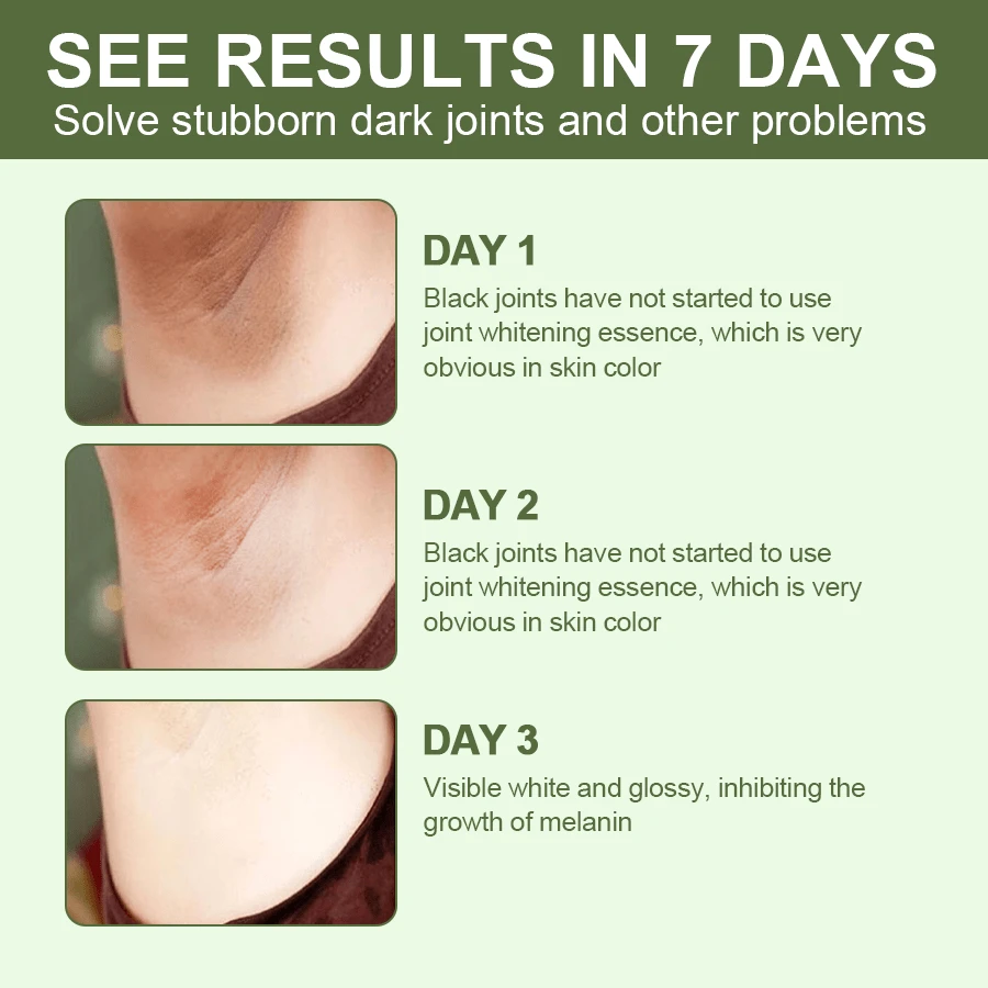 30g Brightening Armpit Cream - Powerful Whitening, Fade Dark Spots ...