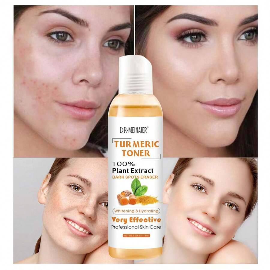 Turmeric Water Whitening Hydrating Face Toner Fade Blemishes Dark Spots ...