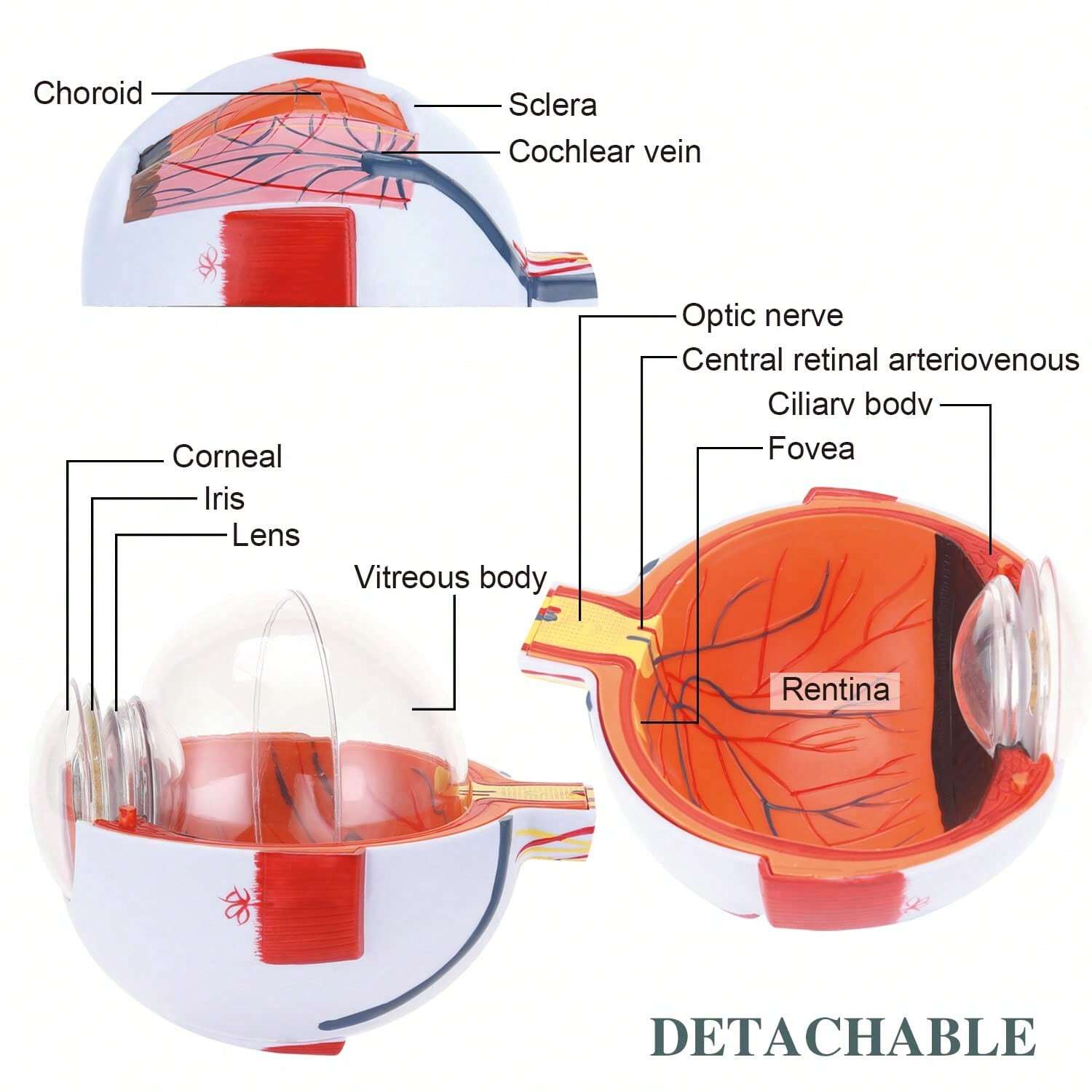 Eye Anatomy Model, 6X Enlarged Eyeball Model, Human Eye Anatomical ...