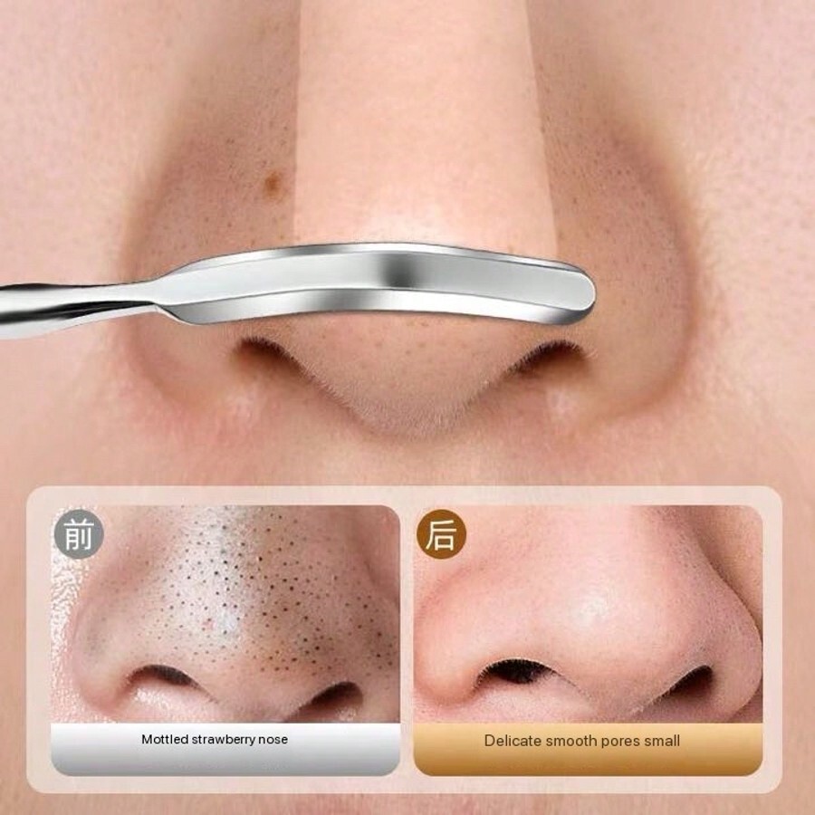 Der neue doppelköpfige Edelstahl-Mitesser-Spachtel reinigt die Nase ...