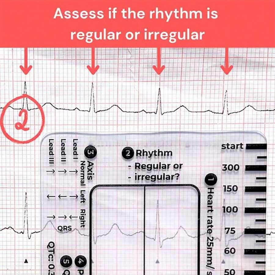 ECG 7 Step Ruler, ECG 7 Step Ruler For ECG/EKG Interpretation, ECG ...