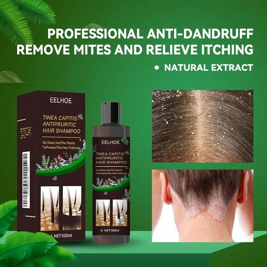 Scalp Ringworm Anti-Itch Shampoo Anti-Drop Refreshing Oil Control Hair ...