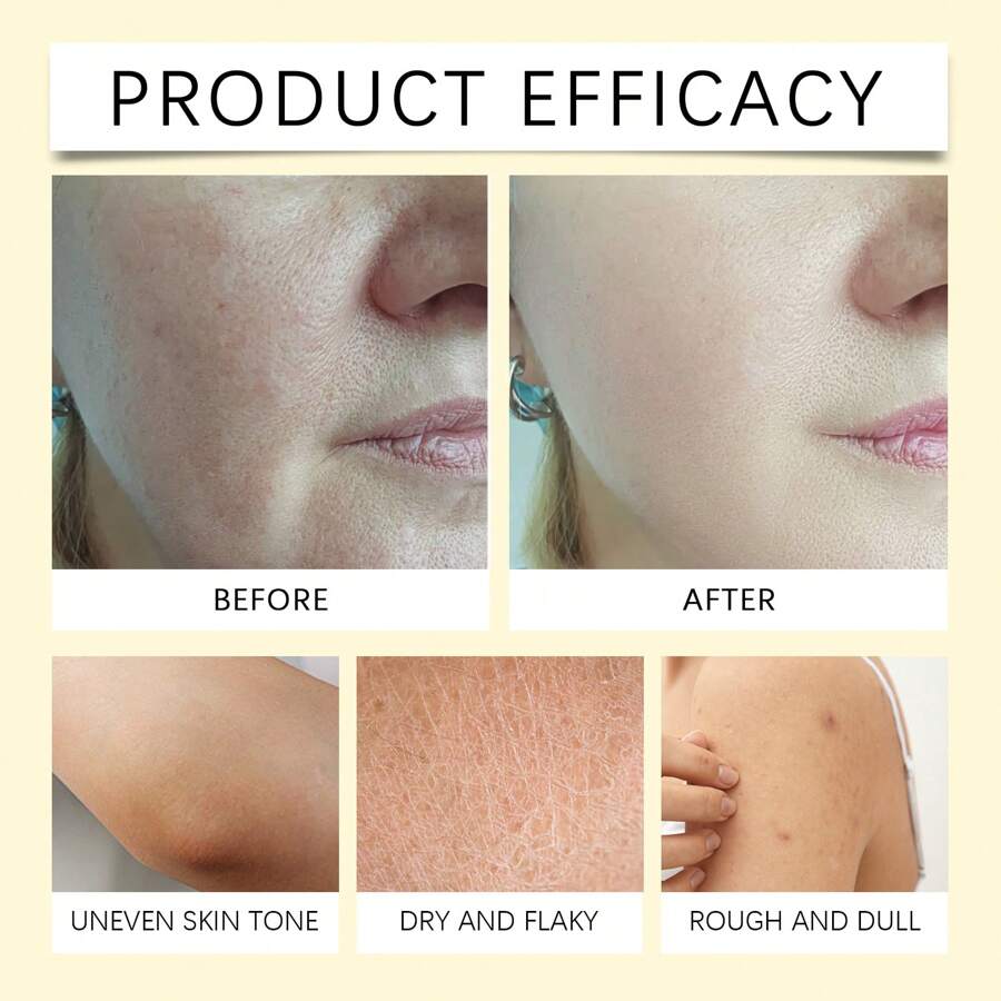 Creme Corporal Hidratante que Melhora o Aspecto Opaco da Pele, Cuidado ...