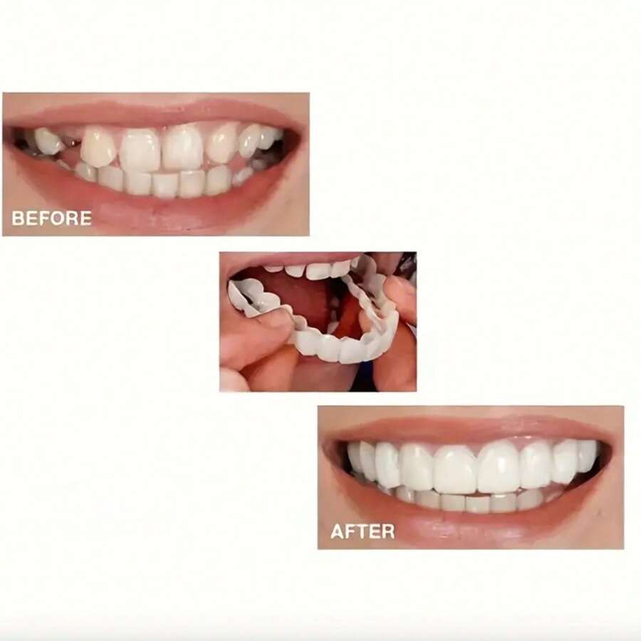 2pcs/Set New Upgrade Nonporous Upper And Lower Teeth Braces, Simulated ...