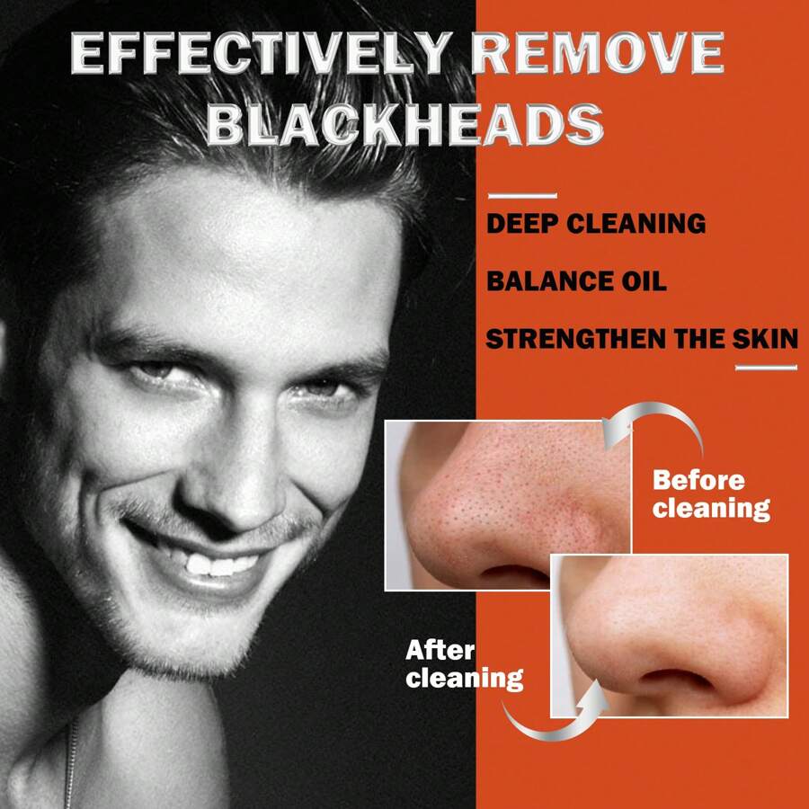 Men's Blackhead Patch, Deep Cleansing Strip To Remove Oil And ...