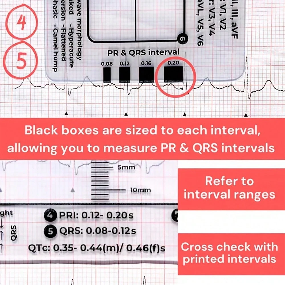 Acrylic Medical Ruler, 7-Step Diagnostic Guide, Waveform Measurement ...