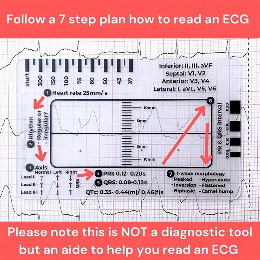 Acrylic Medical Ruler 7 Step Diagnostic Guide Waveform Measurement Tool For Cardiac Reading