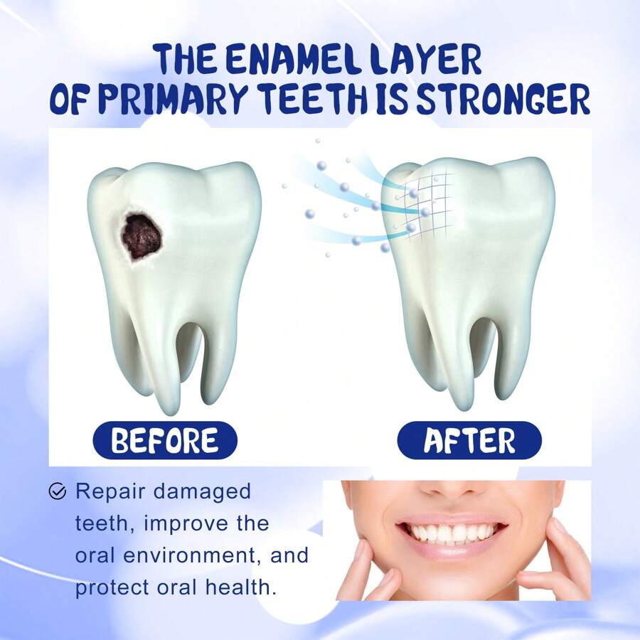 Oralhoe Anti Cavity Toothpaste For Oral Cleaning, Yellow Tooth Decay ...