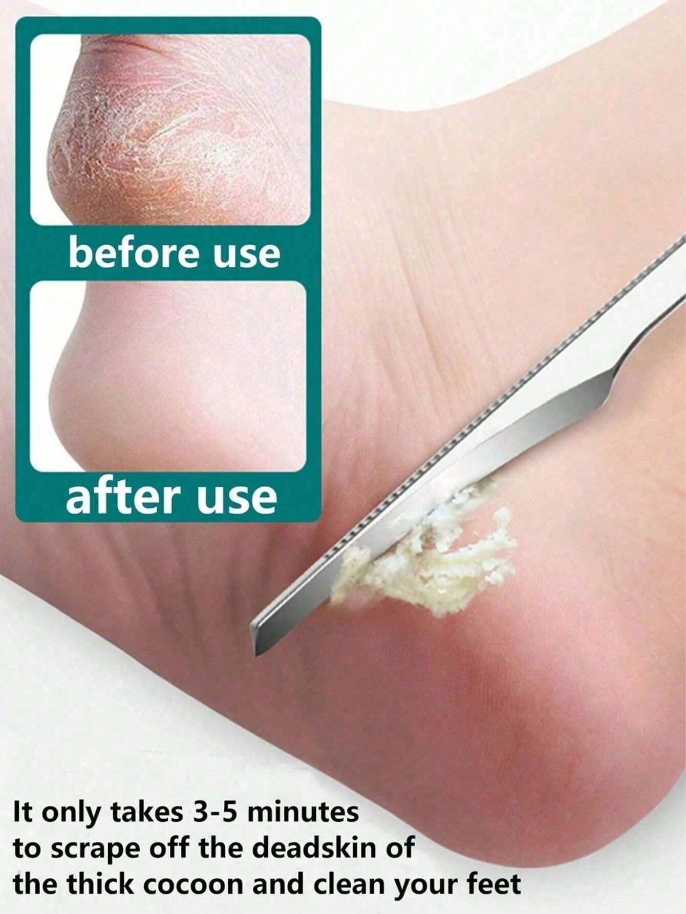 1/2/3 Pcs Stainless Steel Pedicure Kit, Including Callus Remover ...