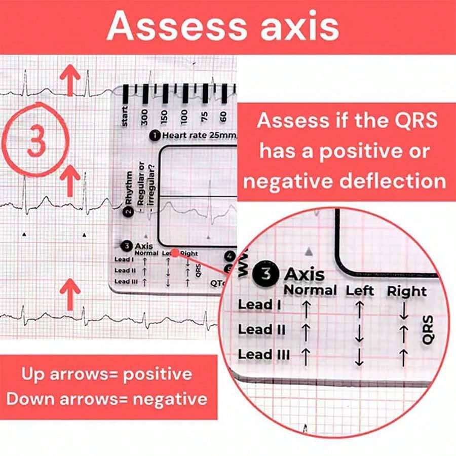 2 pièces Règle ECG à 7 étapes pour l'interprétation de l'ECG, outil de ...