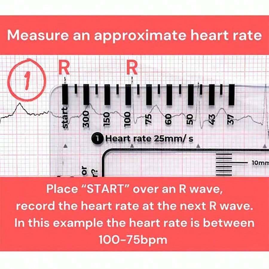 2 pièces Règle 7 étapes ECG pour l'interprétation de l'ECG, suit un ...
