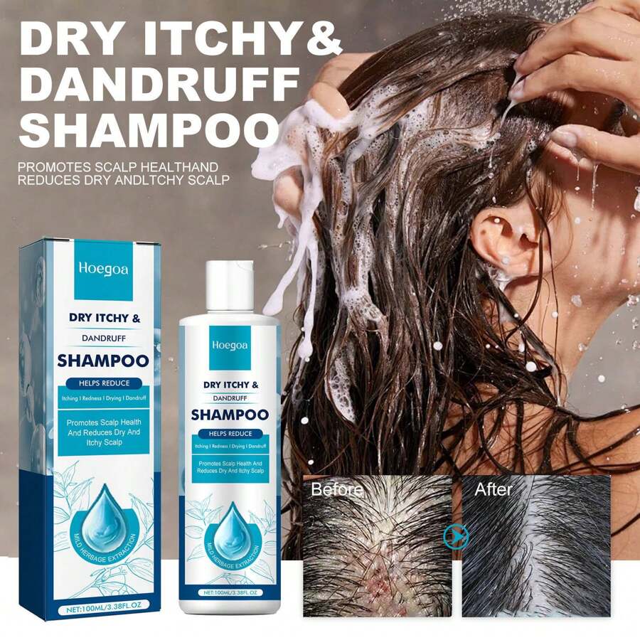100ml Anti-Dandruff & Itchy Scalp Shampoo, Deep Cleansing, Refreshing ...