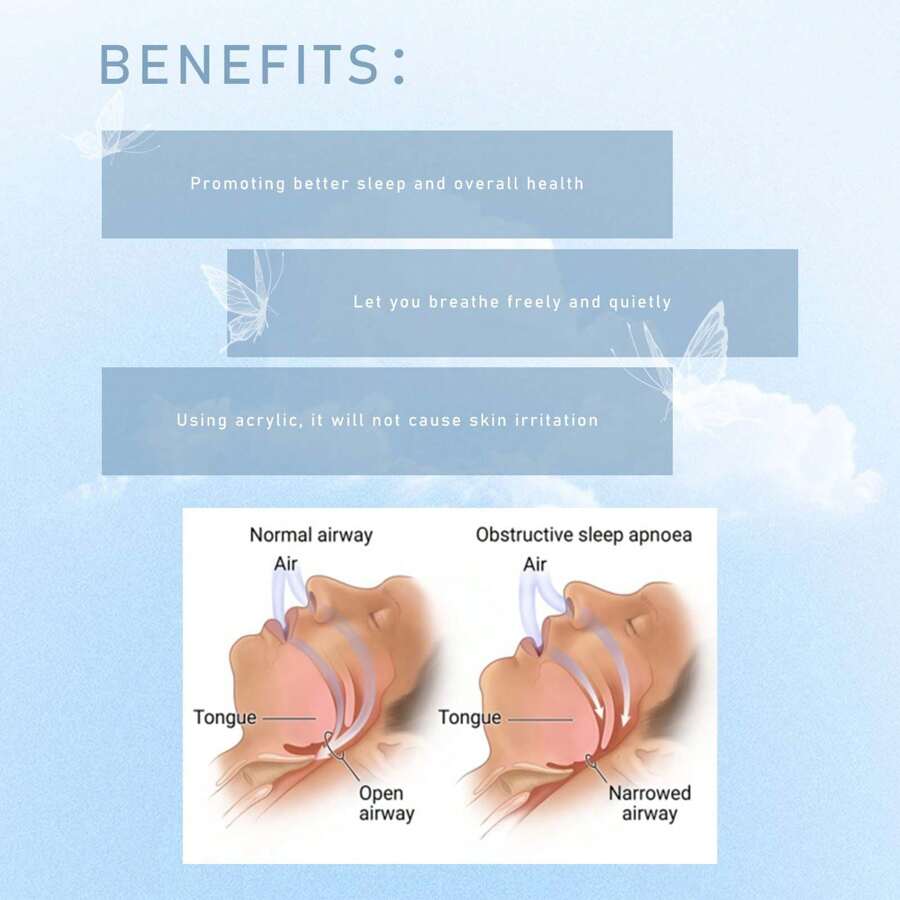 Anti-Snoring Nasal Clips, Relieve Nasal Congestion, Help Sleep, Nighttime Snoring, Breathing ...