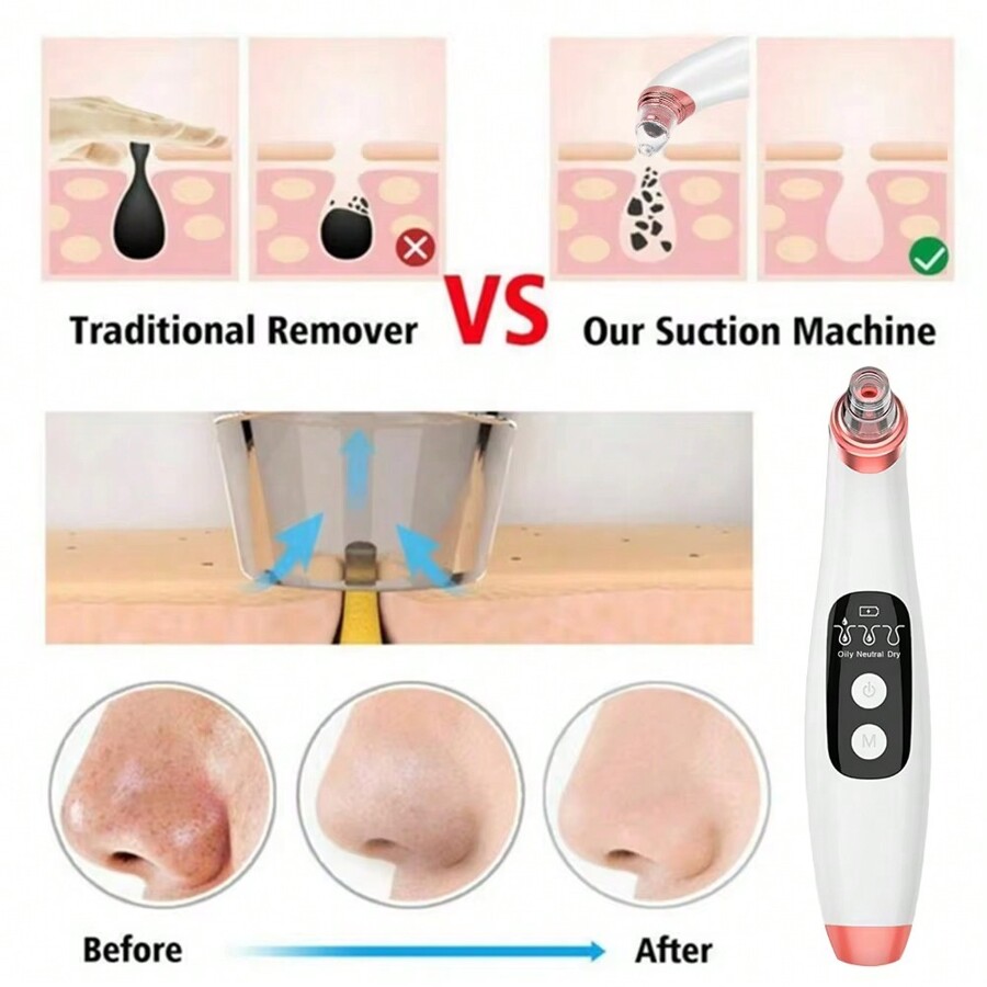 3 Speeds Suction WiFi Connected Display Acne Comedone Extractor Kit ...