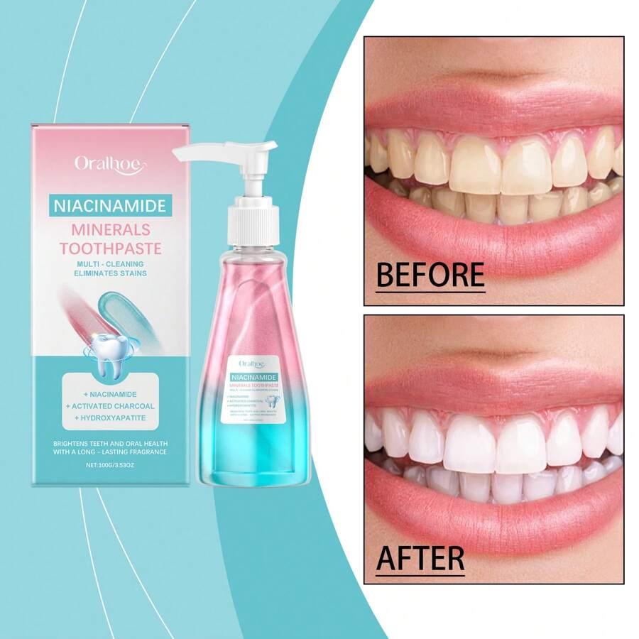 Oralhoe Niacinamide Toothpaste - Gently Freshens, Cleans Plaque, Stains ...