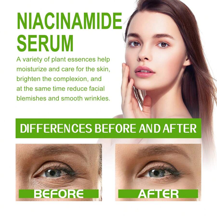 Hoygi Facial Gel Cream Lightens Spots And Fine Lines Repairs Facial ...