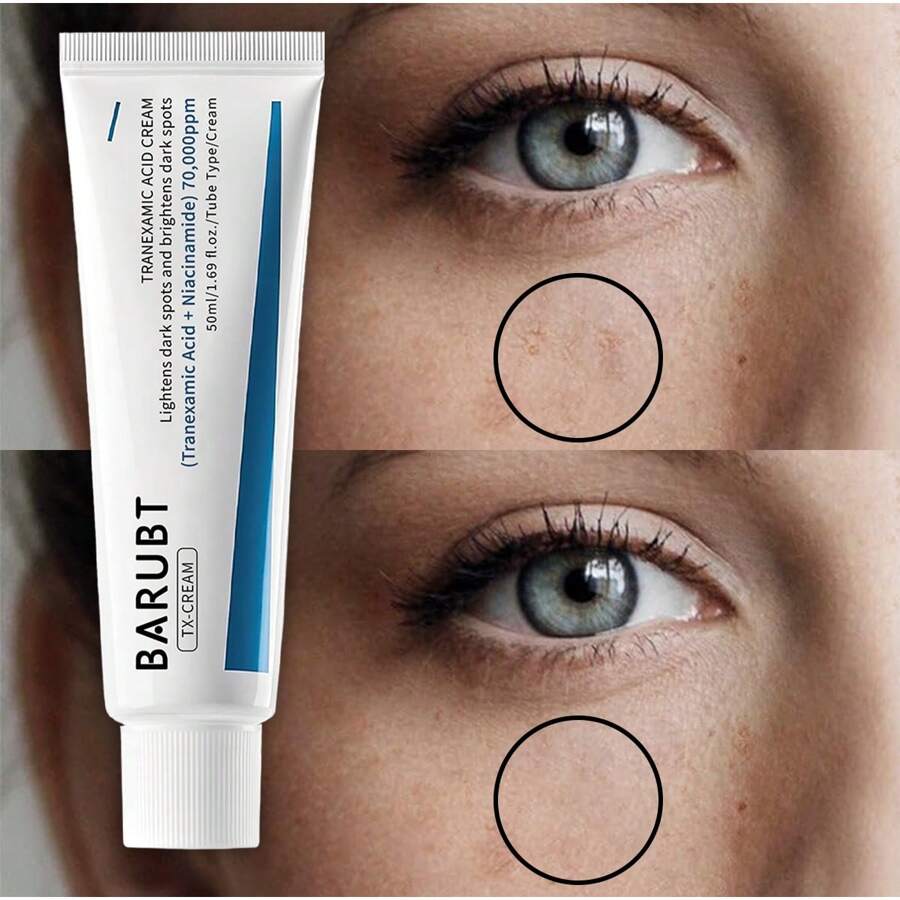 BARUBT 50ml Tranexamic Acid Face Cream, Removes Skin Discoloration ...