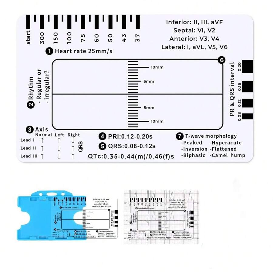 Règle ECG, Règle ECG 7 étapes, Règle ECG 7 étapes pour l'interprétation ...