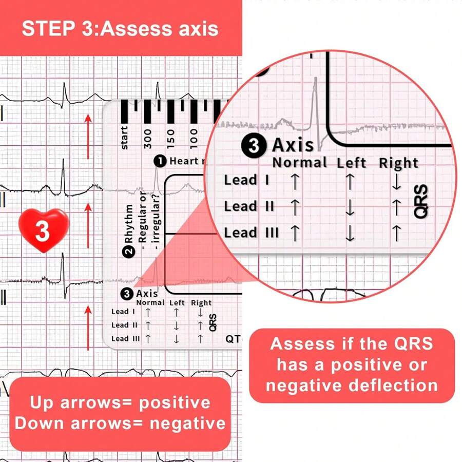 Règle ECG, Règle ECG 7 étapes, Règle ECG 7 étapes pour l'interprétation ECG/EKG, Rapporteur EKG ...