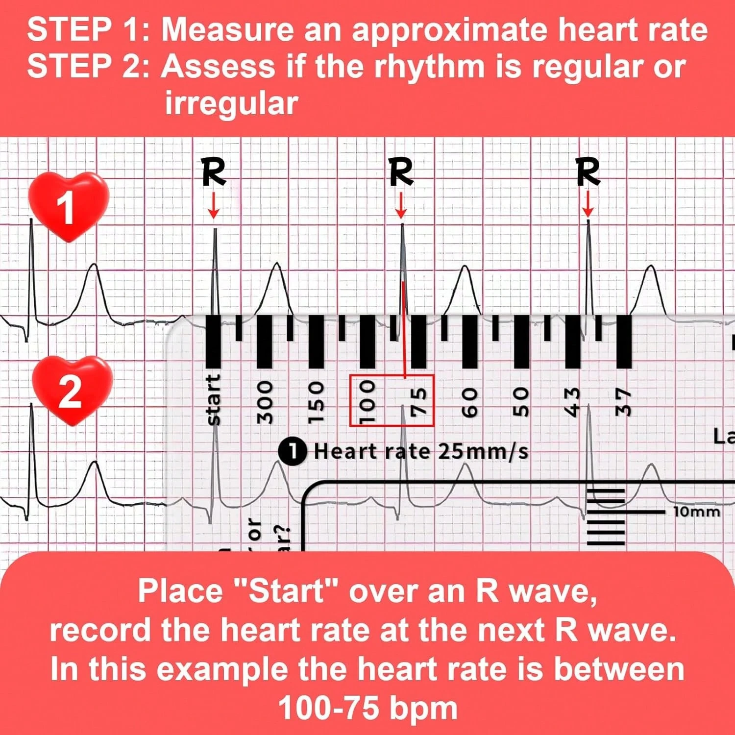 Règle ECG, Règle ECG 7 étapes, Règle ECG 7 étapes pour l'interprétation ECG/EKG, Rapporteur EKG ...