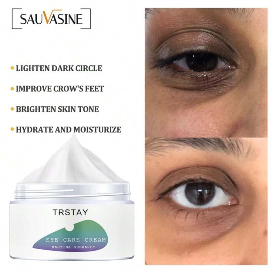 TRSTAY: Eye Care Cream Instantly Reduces Swelling, Tightens And ...