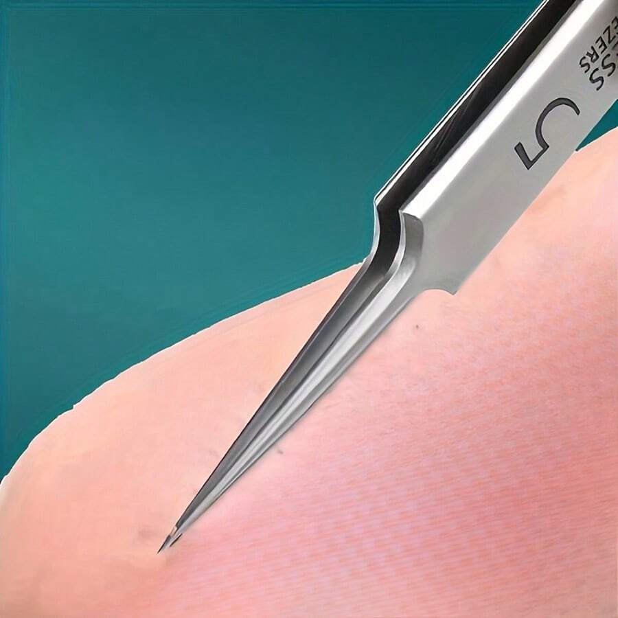 Stainless Steel Odorless Acne Extractor Tool, Blackhead And Blemish ...