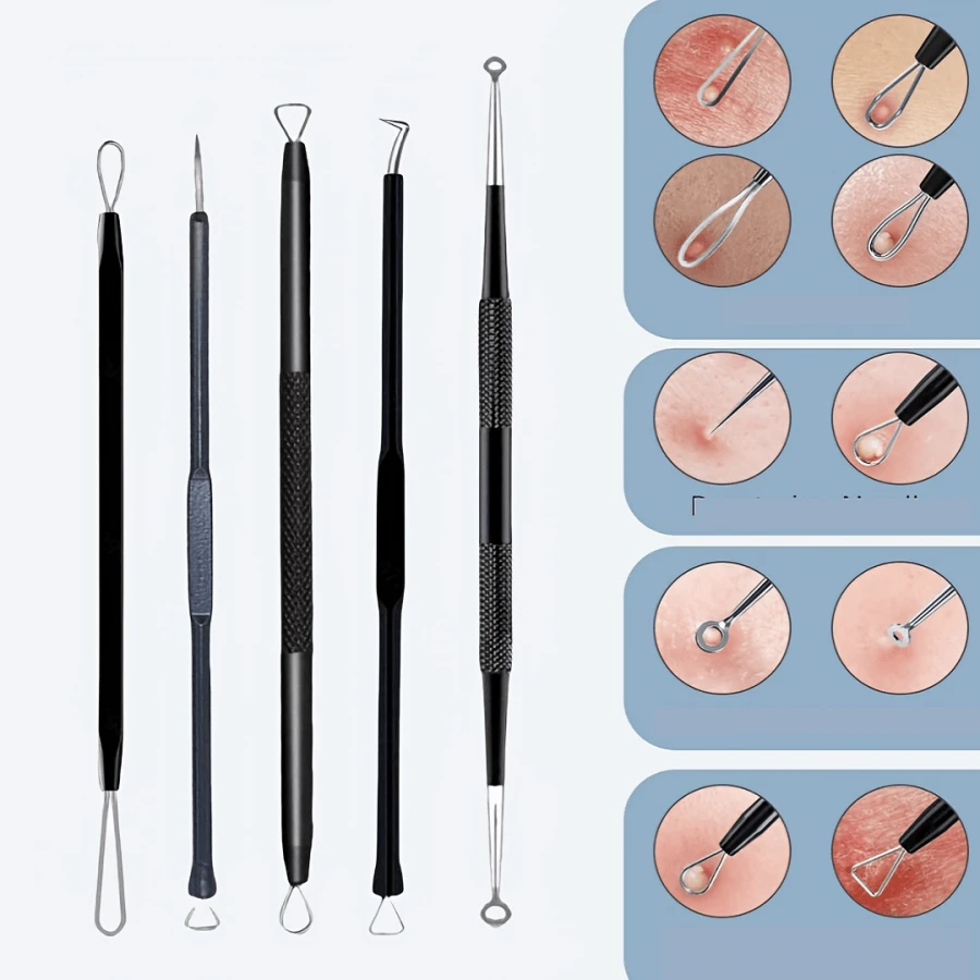 Kit de 11 pièces de kit d'extraction des points noirs en acier ...