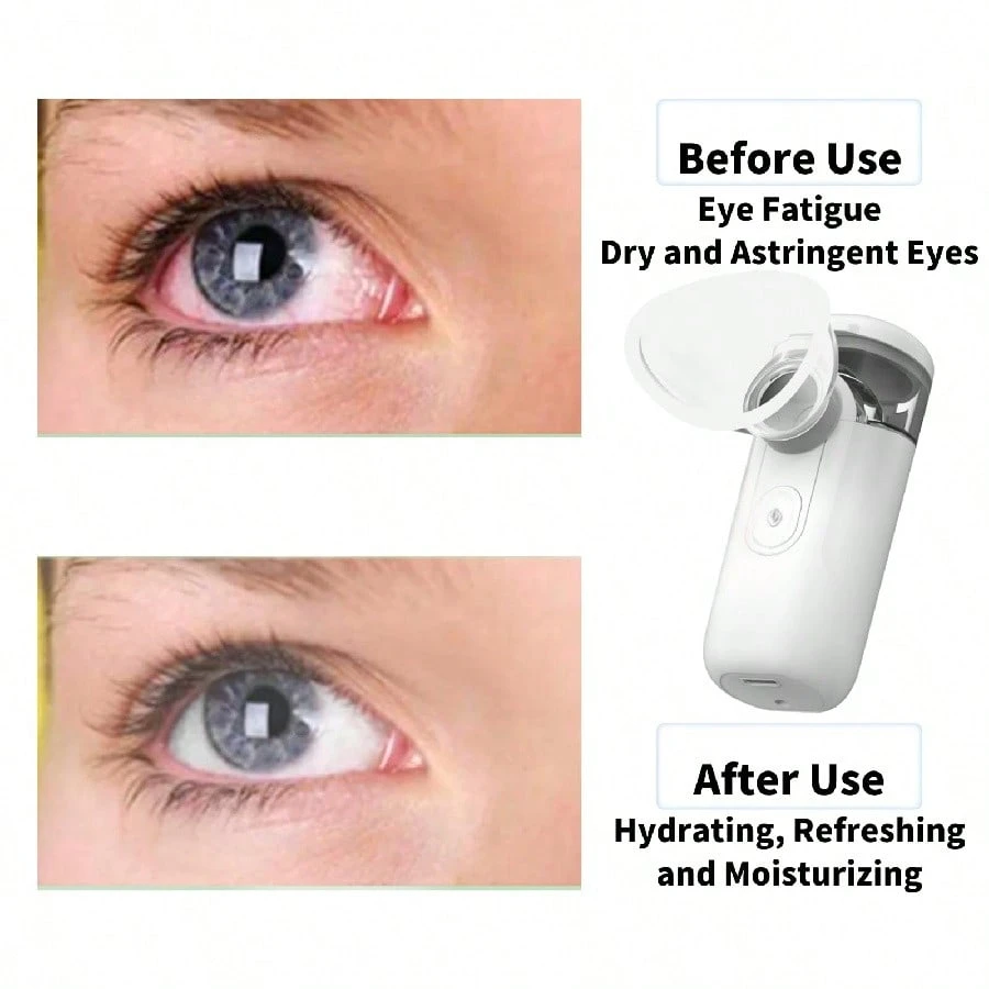 Eye Heating Nano Atomizer Sprayer Portable Hot Compress Eye Sprayer For ...