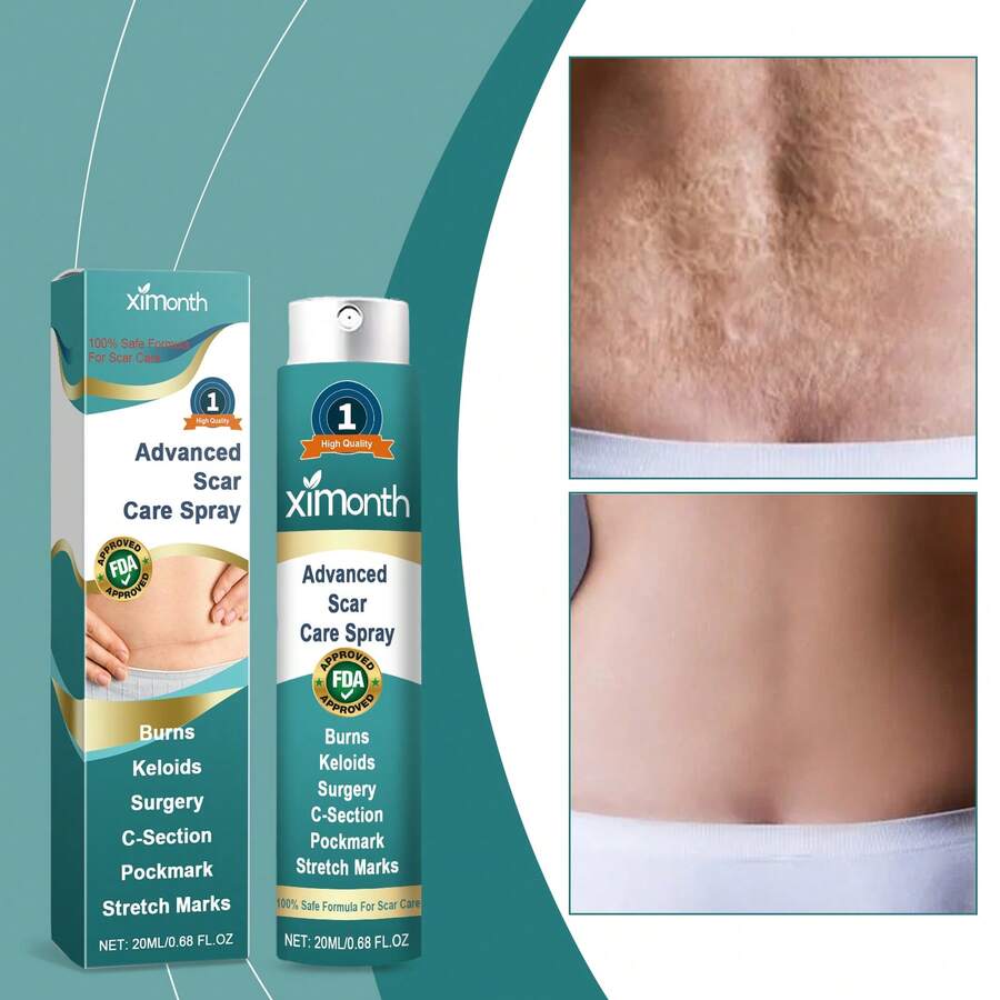 Advanced Scar Care Spray | Natural Extracts For Scar Reduction & Skin ...