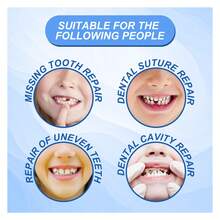 Solid Dental Glue Modification Teeth Temporary Filling Holes Filling ...