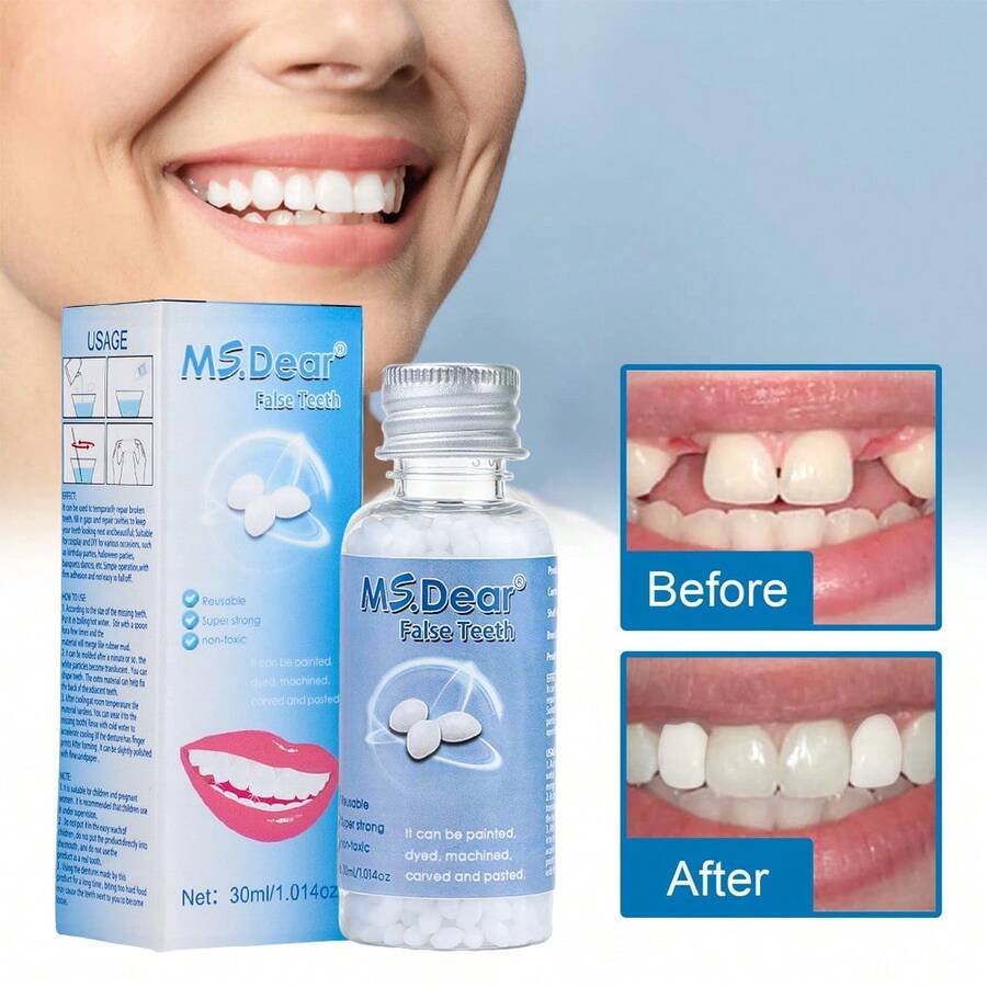 30ml Moldable Teeth Glue Kit - Temporary Denture Repair For Missing ...