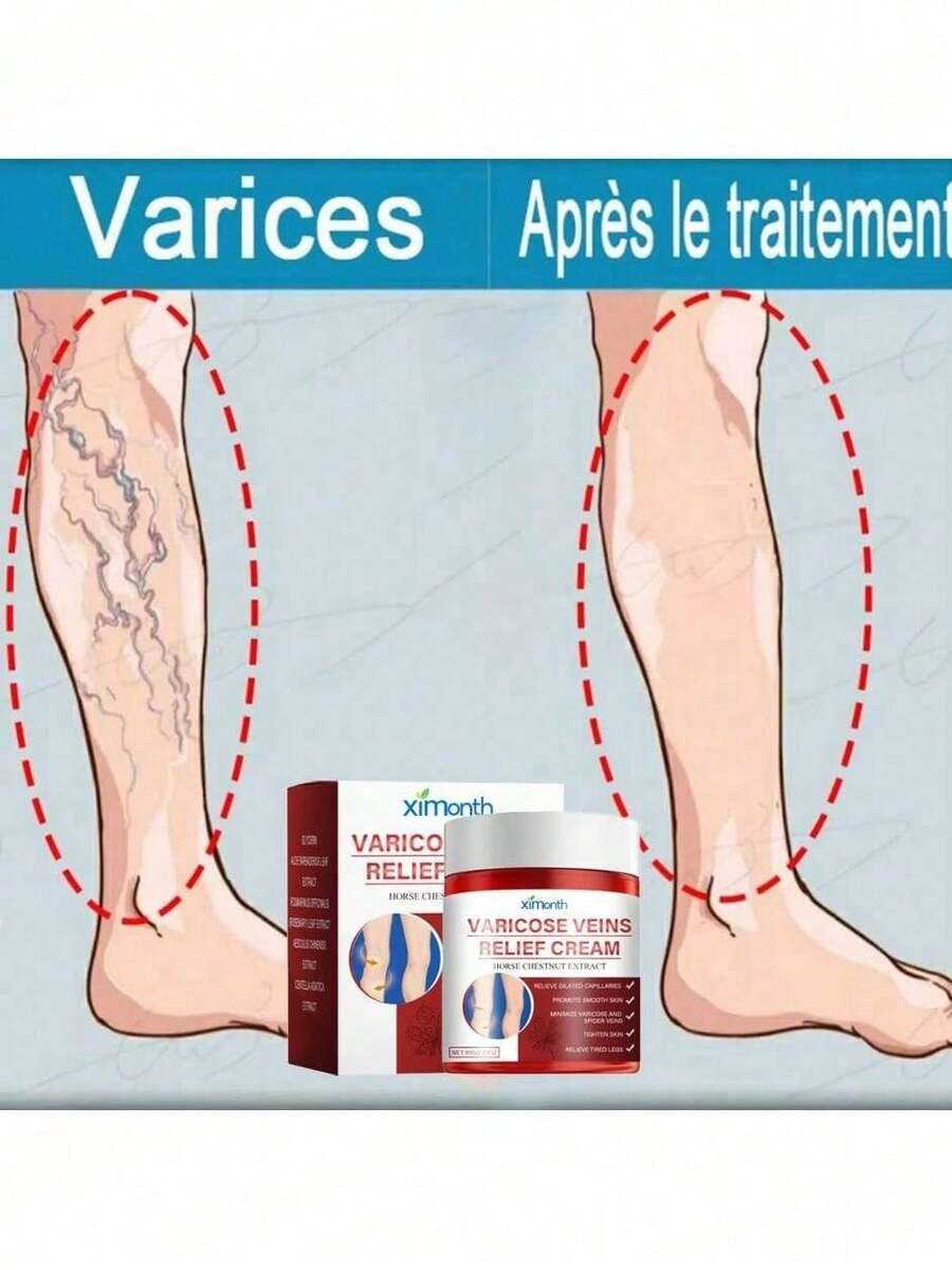 Vein Repair, Painless Treatment For Varicose Veins, Leg Massage To ...