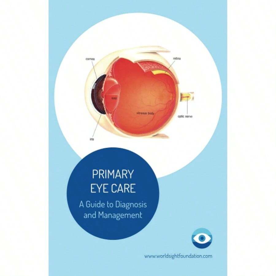 Primary Eye Care: A Guide To Diagnosis And Management | SHEIN USA