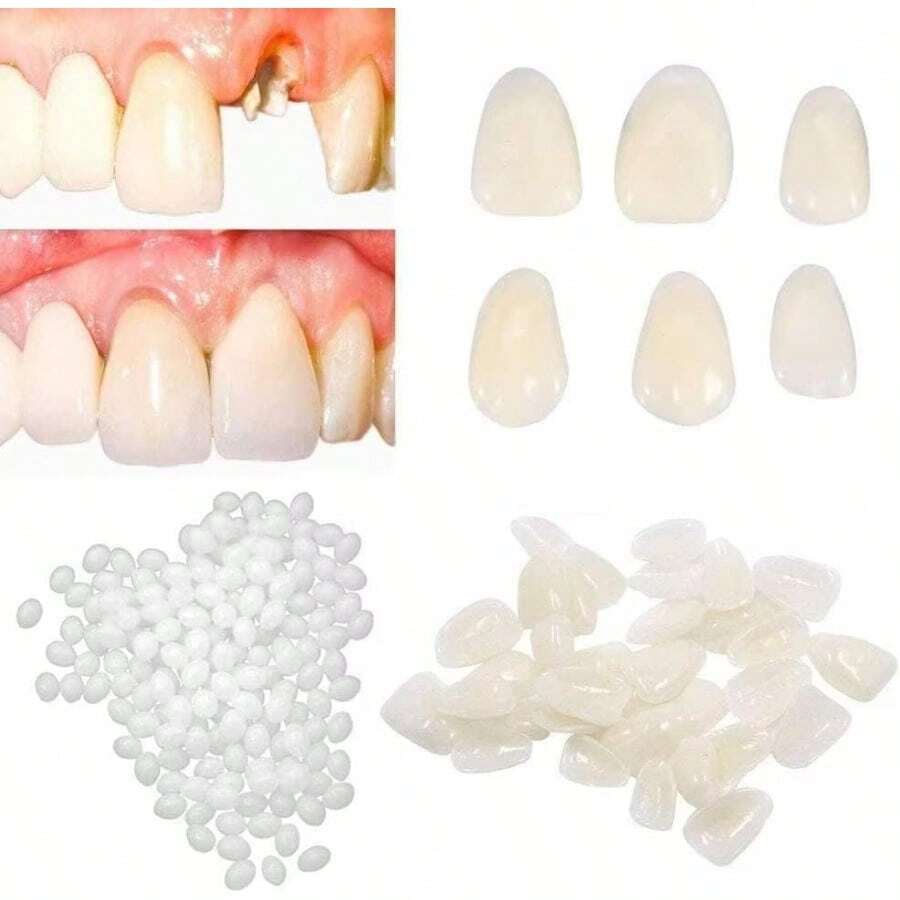 Fake Toot Repair Kits Filling Te Missing Ken Toot And Gaps-Moldable And ...