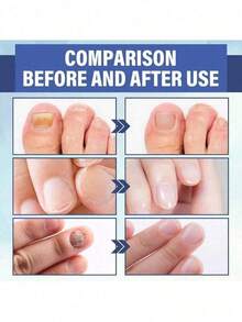 This Multi-Functional Nail Repair Tool Is Alcohol-Free And Contains ...