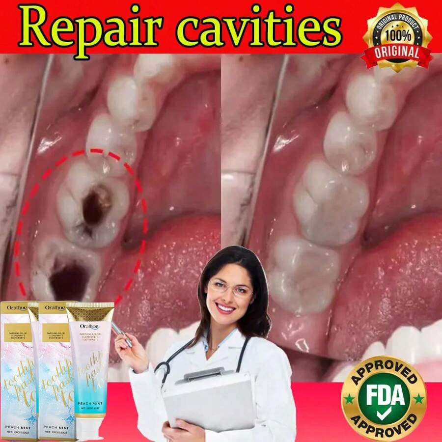 Oralhoe Toothpaste Freshens Breath, Nourishes Gums, Gently Cleans Teeth ...