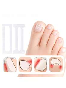 10pcs Ingrown Toenail Corrector Strips, Physical Stretching Tape ...