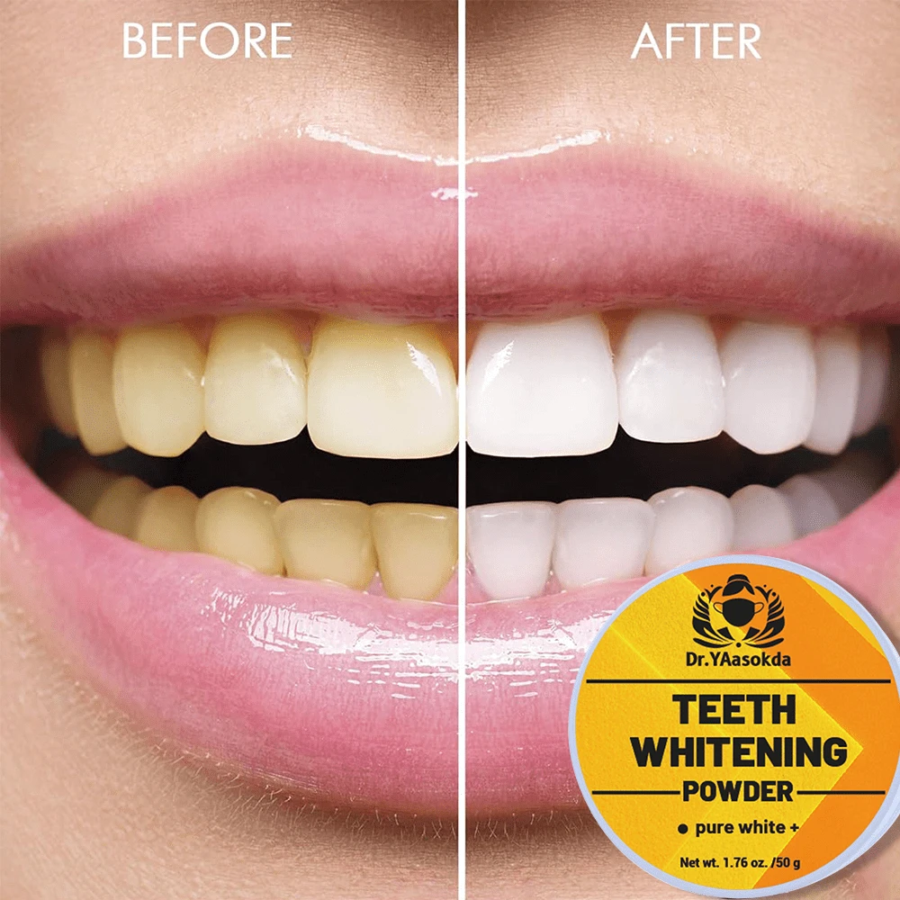 Teeth Whitening Powder – Instantly Brighten Your Smile & Freshen Breath ...